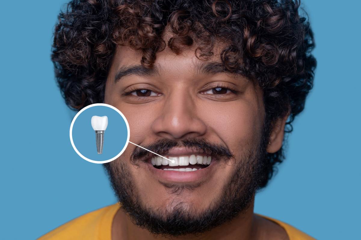 How To Clean Dental Implants Victory Plaza Dental Group Blog