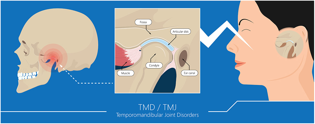 TMJ Treatment North Hollywood | Victory Plaza Dental Group